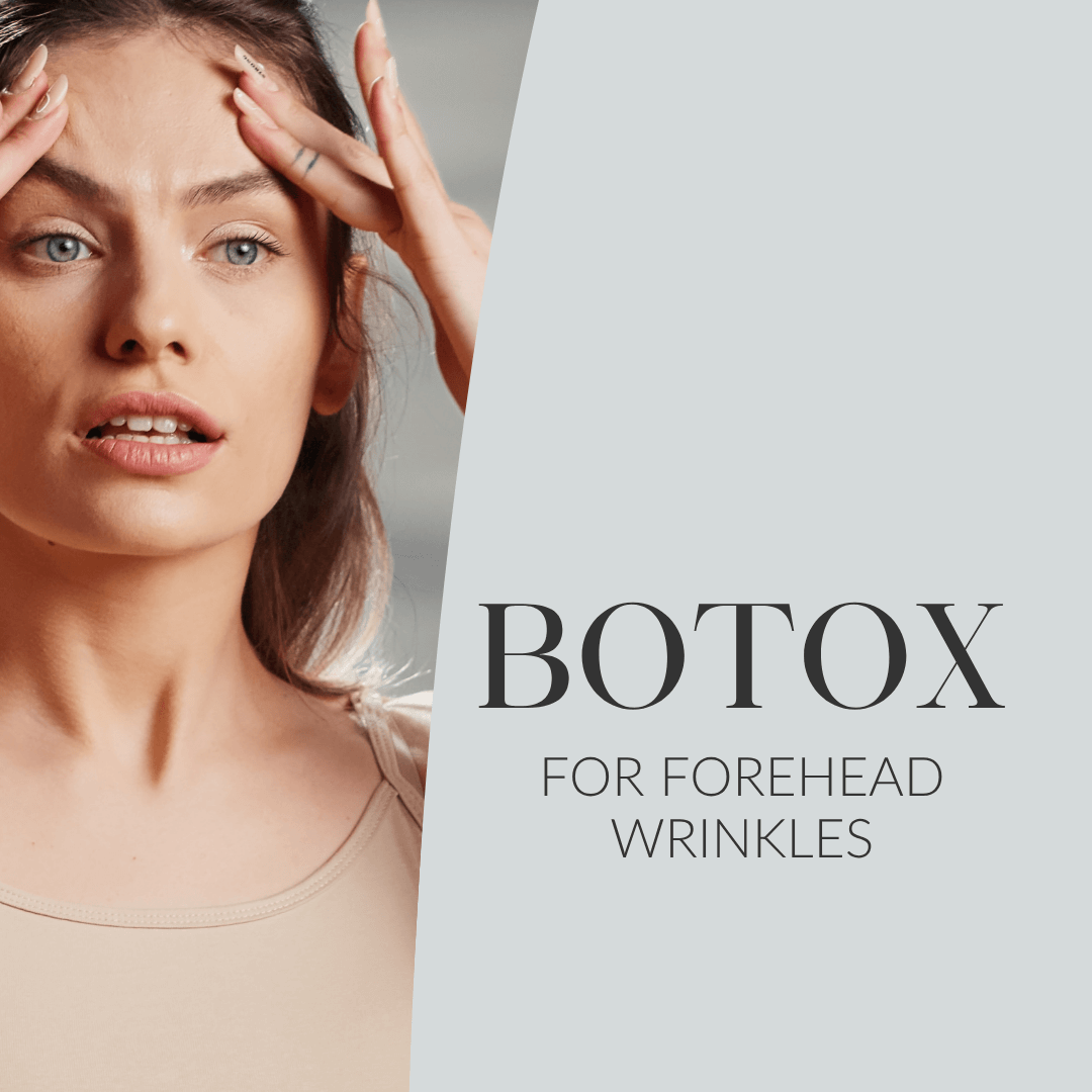 Botox: Horizontal Forehead Lines - Decus